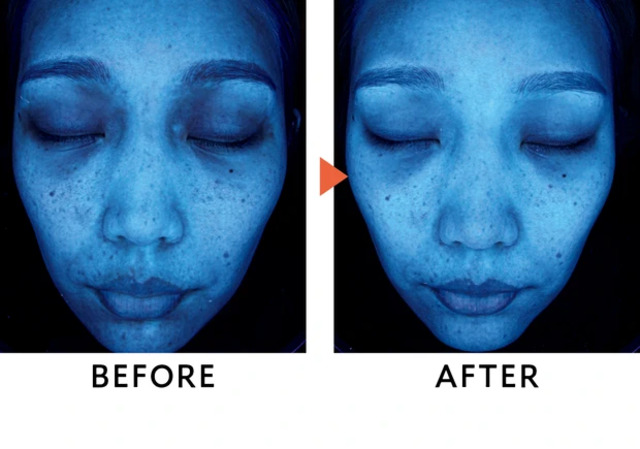 写真 (11枚目) - [2025年]日焼け止めの人気ランキング！顔・体・髪におすすめのUVをご紹介 - LOCARI（ロカリ）