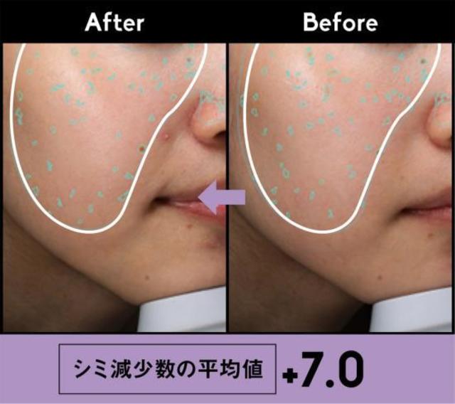 写真 (8枚目) - シミ対策の大本命、美白美容液はETVOS！ - LOCARI（ロカリ）