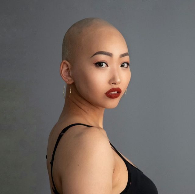 写真 (2枚目) - “自分らしさ”って？ 脱毛症に悩むAYAさんへインタビュー - LOCARI（ロカリ）